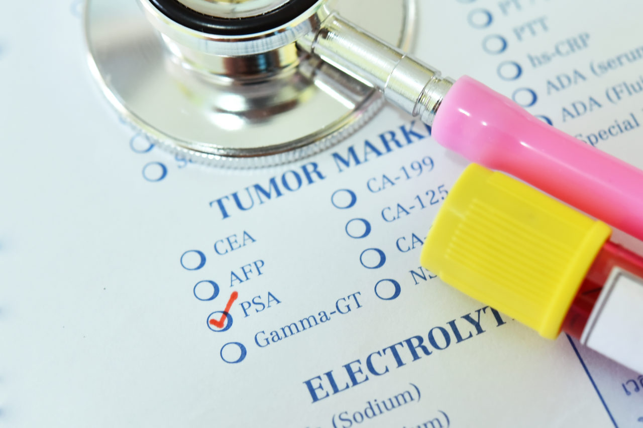 Elevated PSA and Prostate Cancer - Urologist - Urology Austin